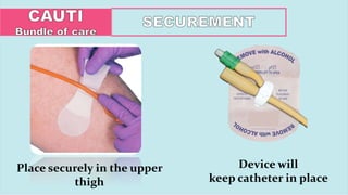 Cauti bundle of care | PPTX