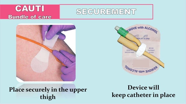 Cauti bundle of care | PPTX