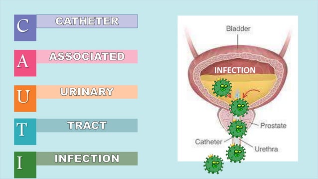 Cauti bundle of care