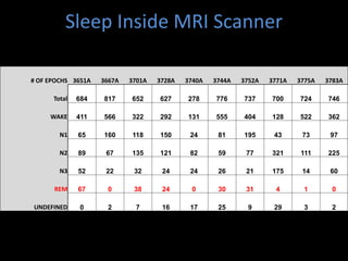 The glymphatic system in sleep and neurodegenerative diseases | PPTX