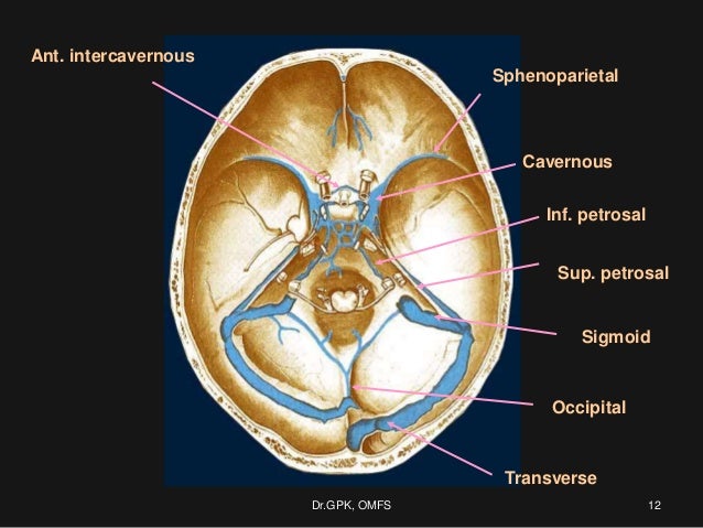 Cavenous sinus thrombosis