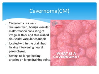 A brief presentation on cerebral Cavernoma.pptx