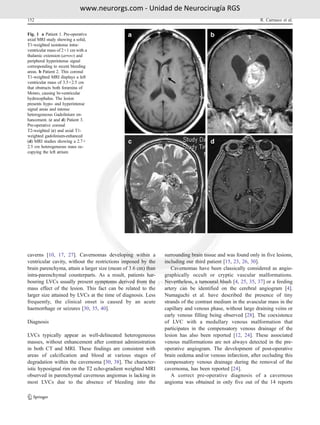 www.neurorgs.net - Cavernous angiomas of the lateral ventricles | PDF