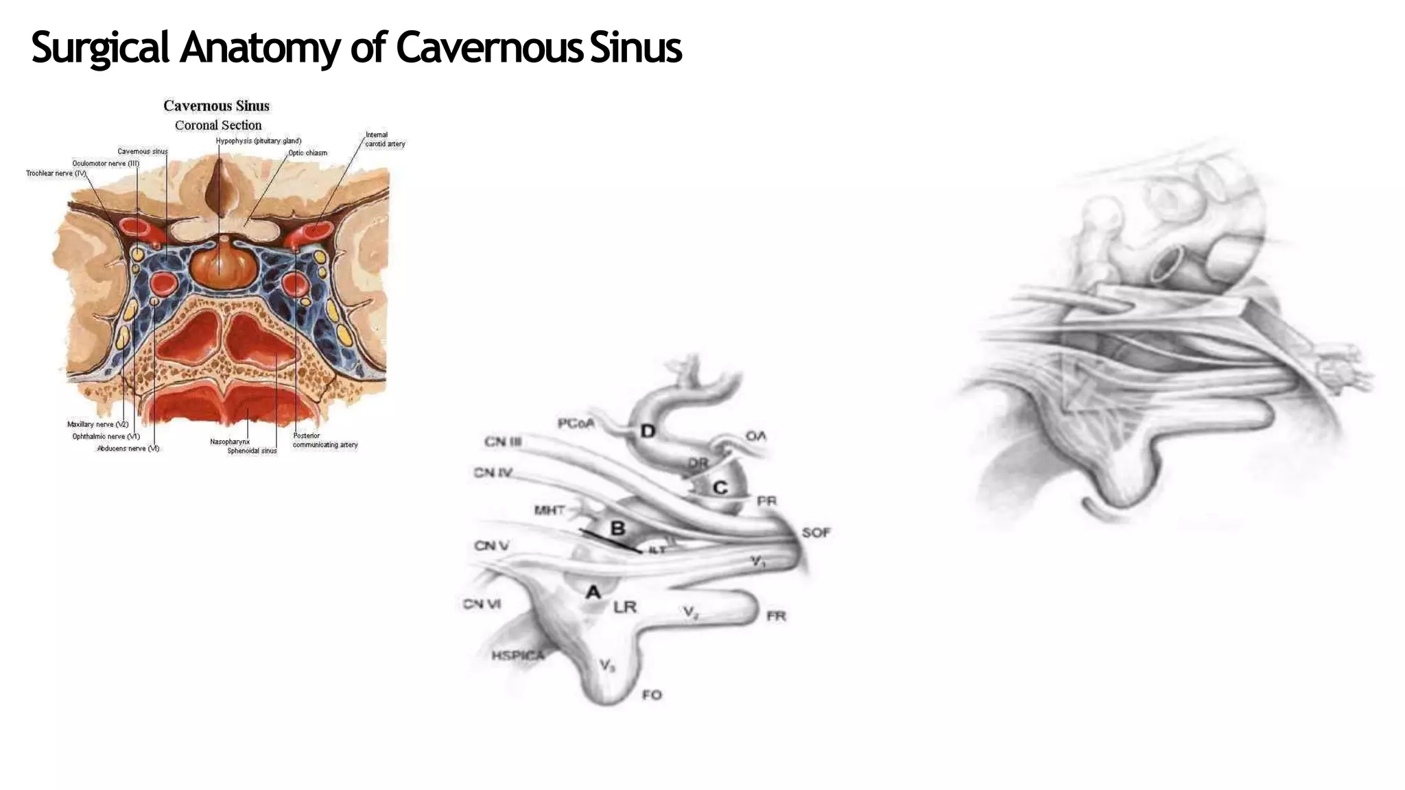 cavernou sinus anatomy.pptx