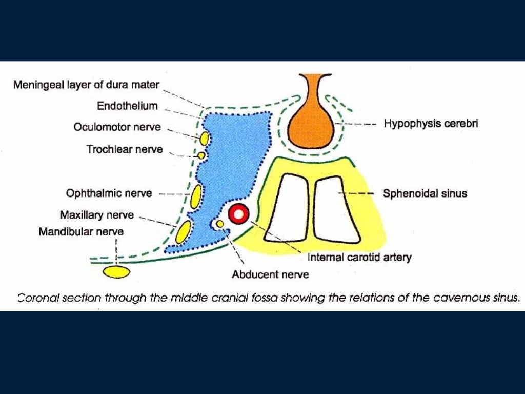 Cavernous sinus