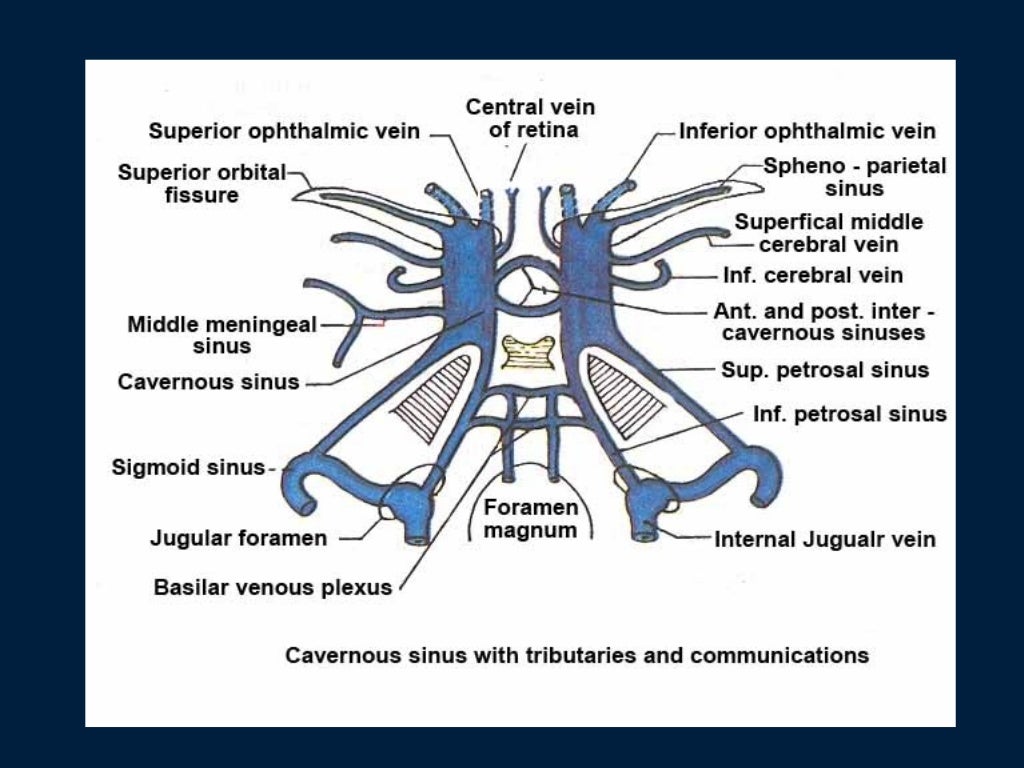 Cavernous sinus
