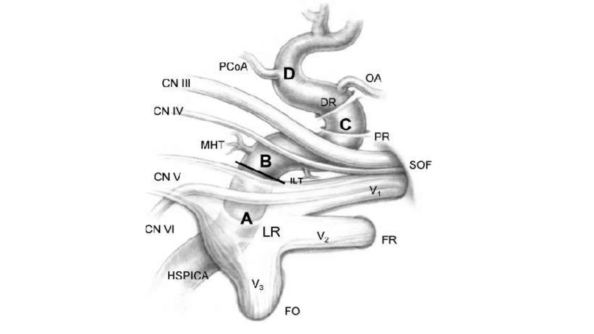Cavernous sinus | PPTX