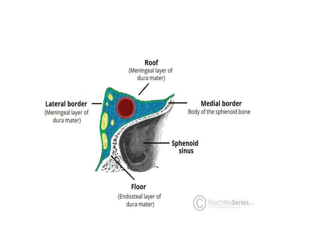 Cavernous sinus anatomy and clinical significance | PPTX