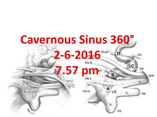 Cavernous sinus 360° | PPTX | Ear, Nose and Throat Conditions ...
