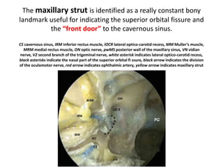 Cavernous sinus 360° | PPTX