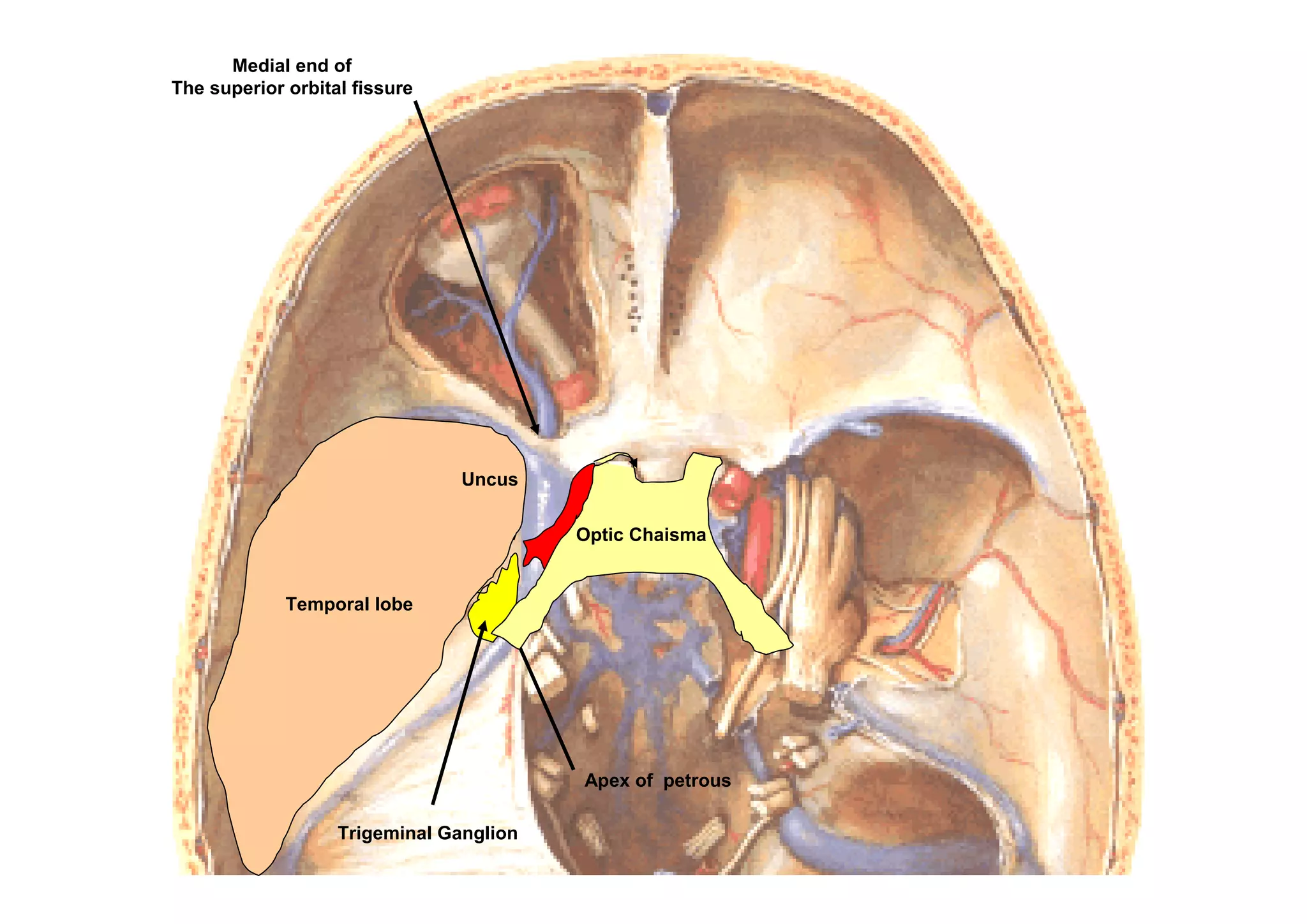 Cavernous sinus anatomy | PDF