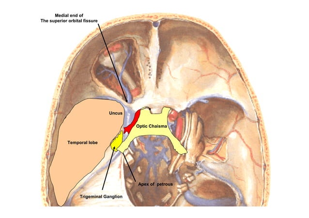 Cavernous sinus anatomy | PDF