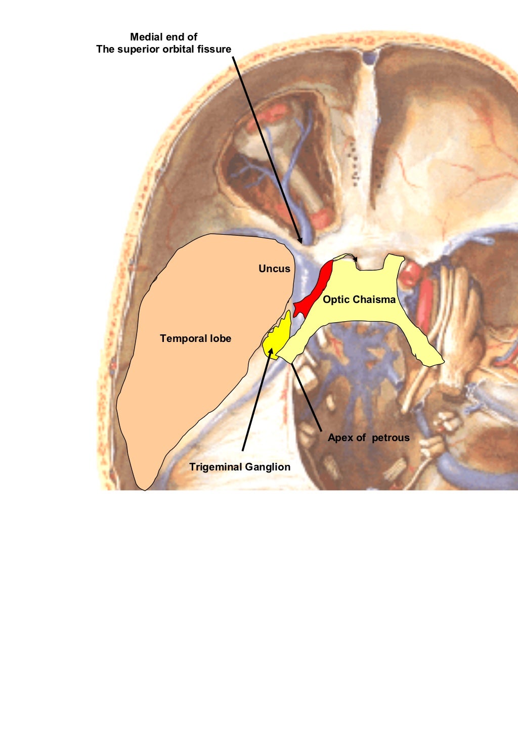 Sinus Cavernosus , Sinus cavernosus: Anatomie, Lage, Funktion – PCWH