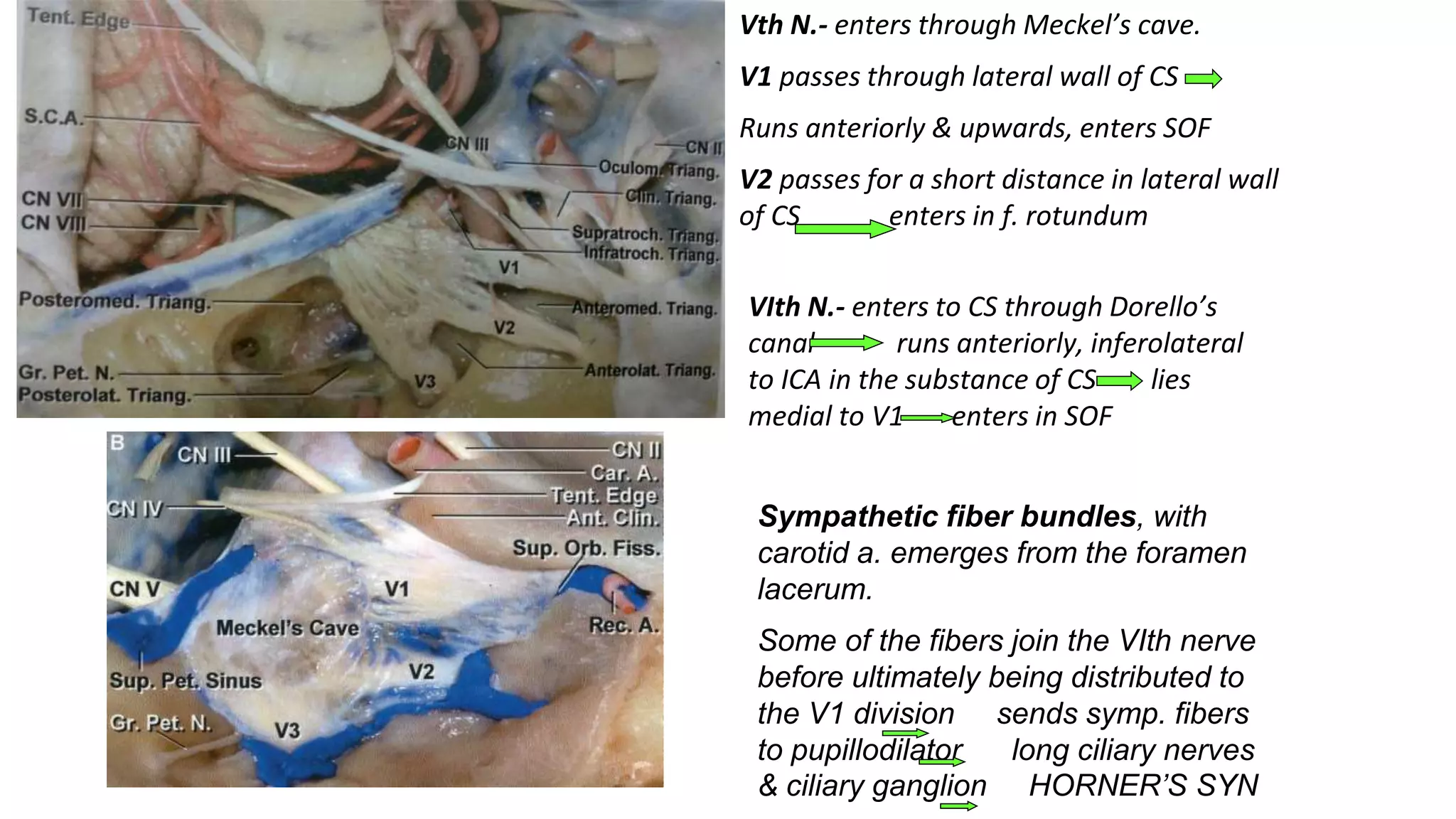 Cavernous sinus-ANATOMY AND SURGICAL APPROACHES | PPTX