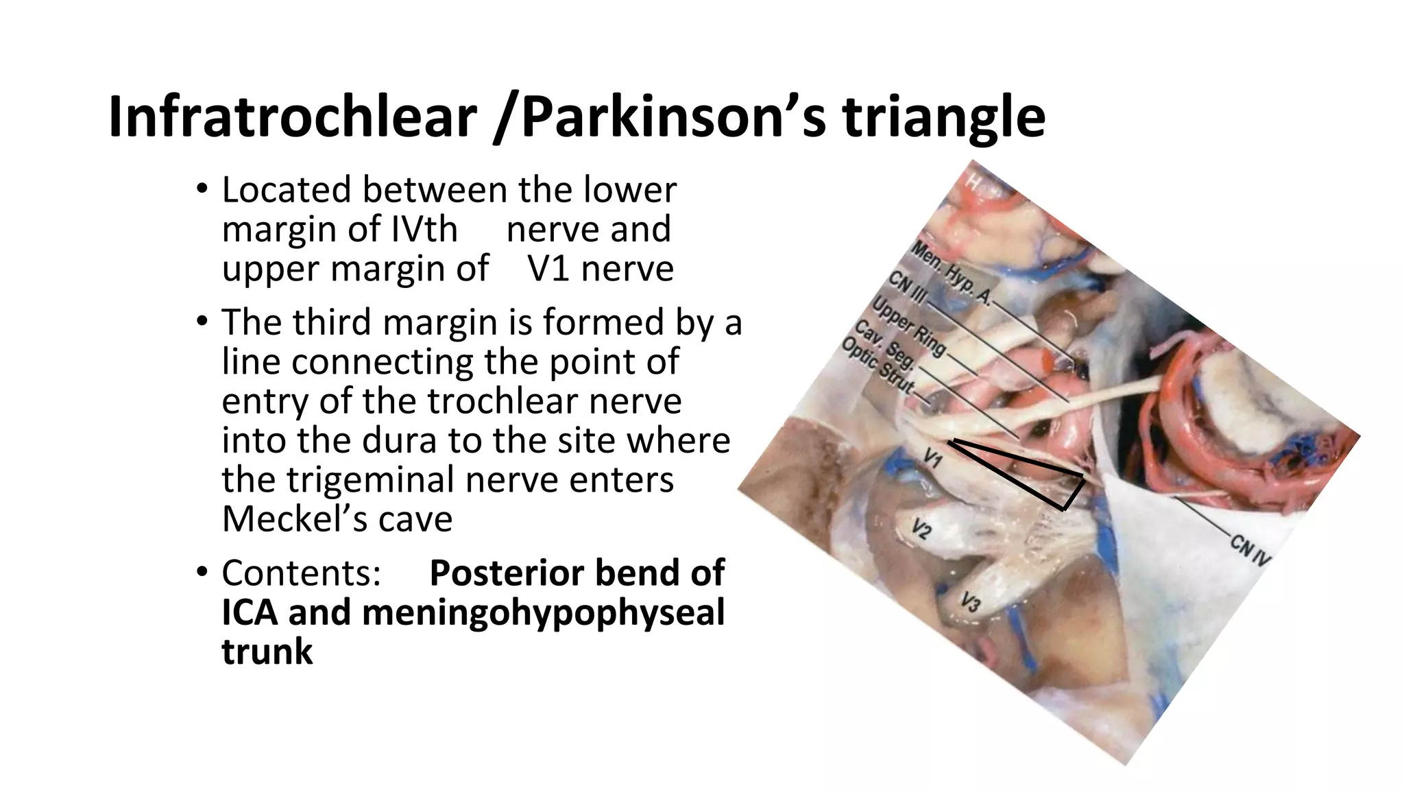 Cavernous sinus-ANATOMY AND SURGICAL APPROACHES | PPTX