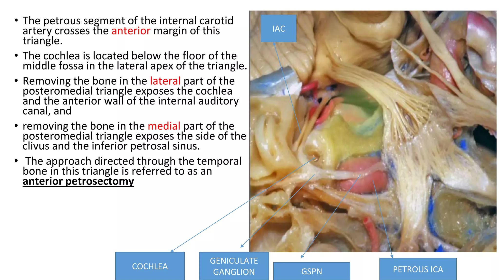Cavernous sinus-ANATOMY AND SURGICAL APPROACHES | PPTX