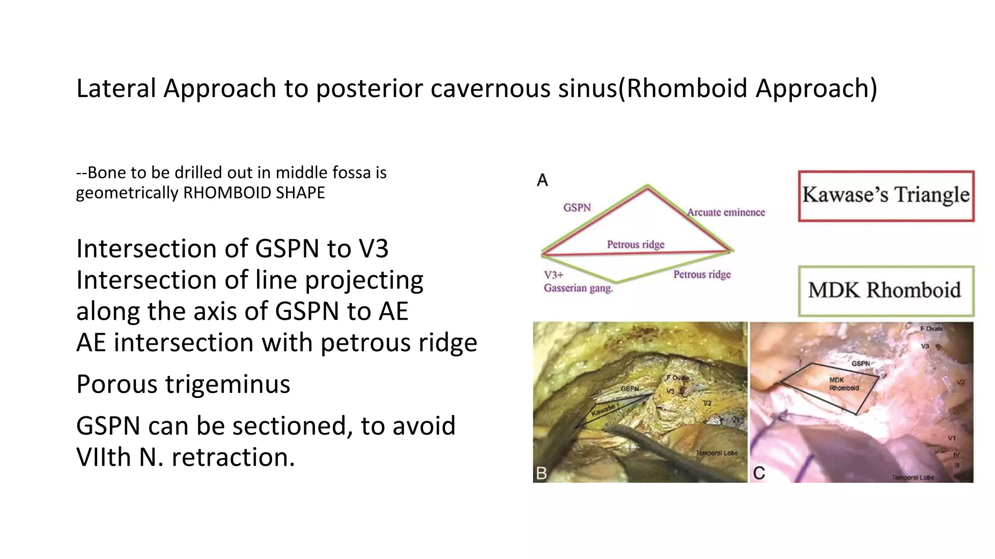 Cavernous sinus-ANATOMY AND SURGICAL APPROACHES | PPTX