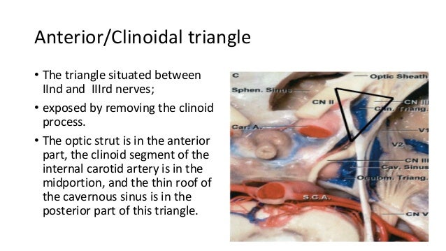 Cavernous sinus-ANATOMY AND SURGICAL APPROACHES