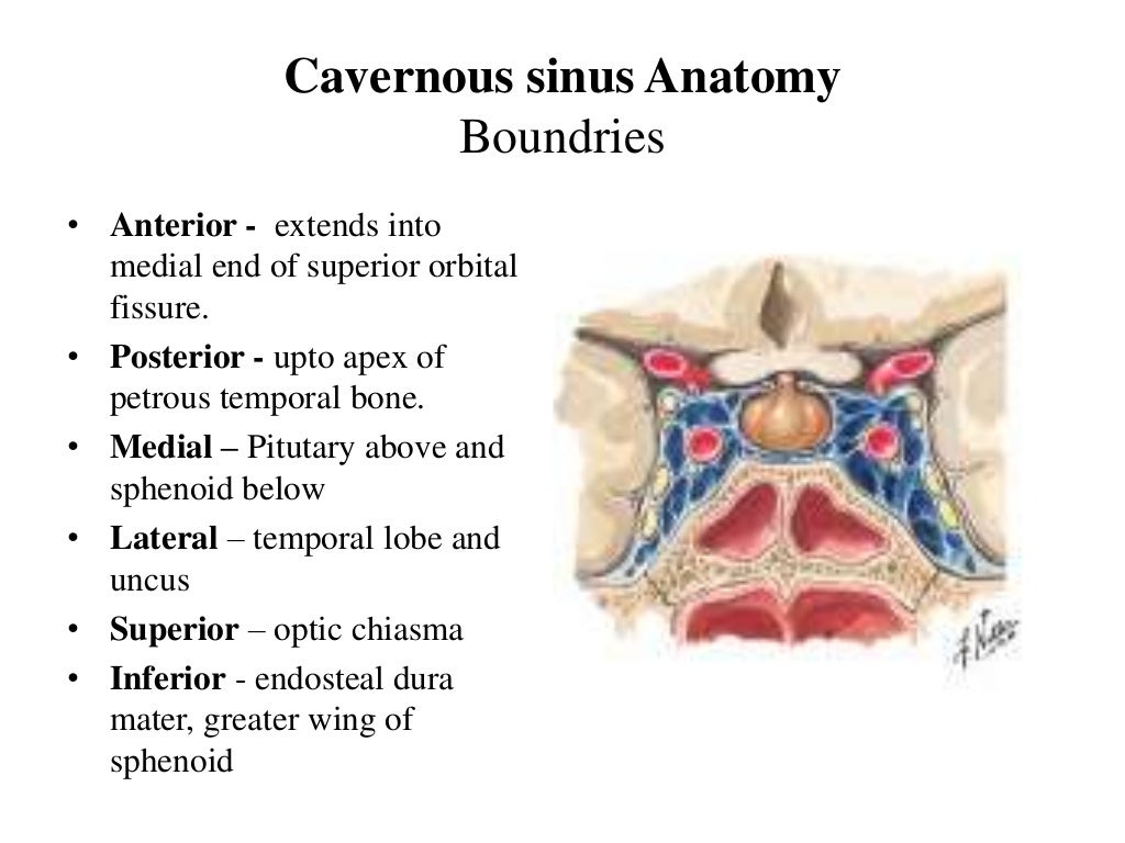 Cavernous sinus thrombosis.pdf ppt