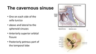 Cavernous Sinus Thrombosis | PPTX