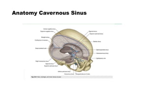 Cavernous Sinus Thrombosis | PPTX