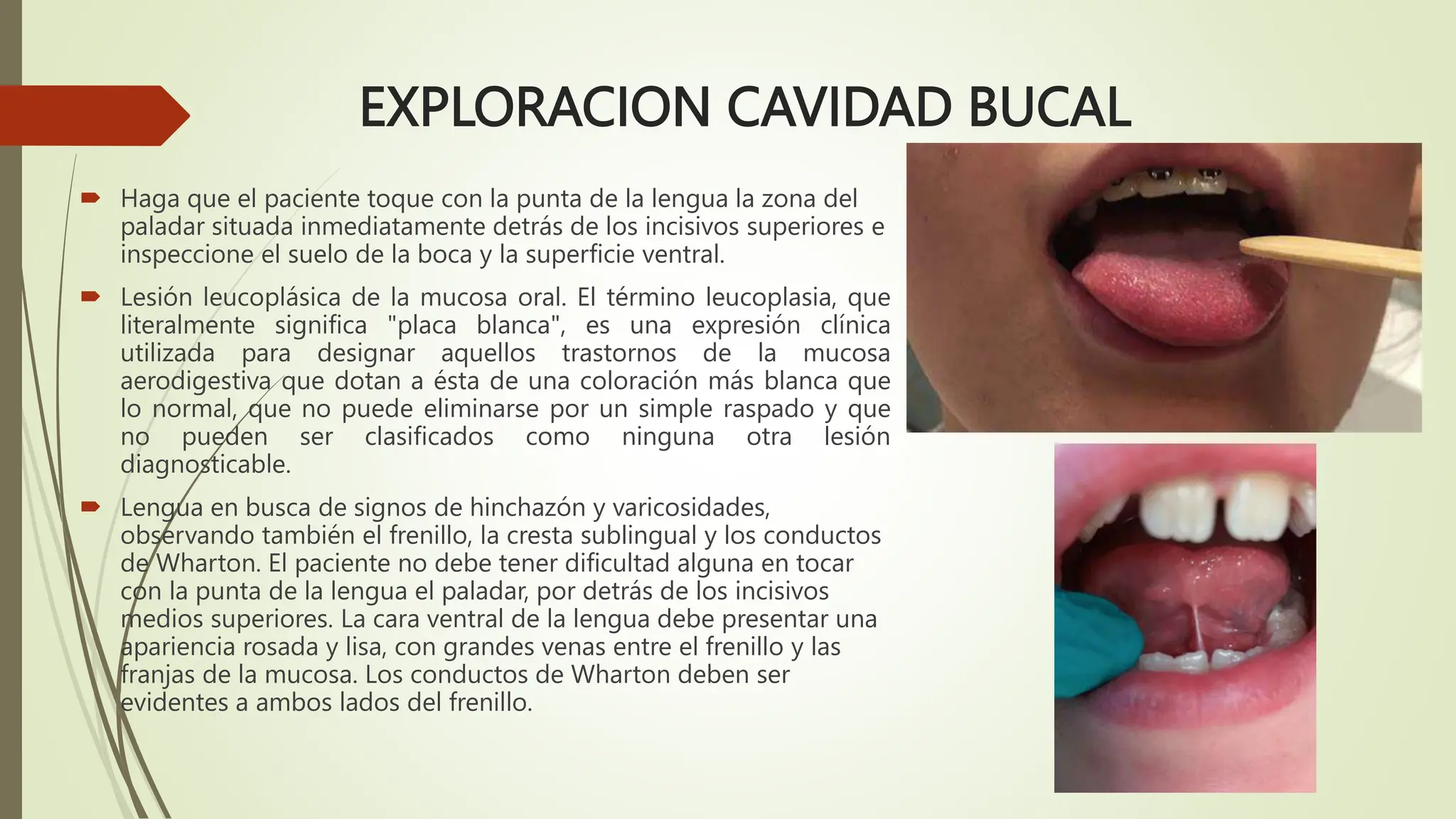 Cavidad Bucal, Esofago, glándulas salivales.pptx