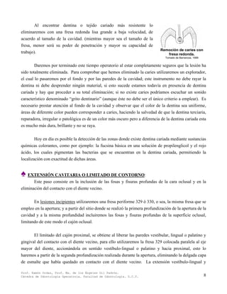 Cavidad_clase_dos_amalgama2.pdf
