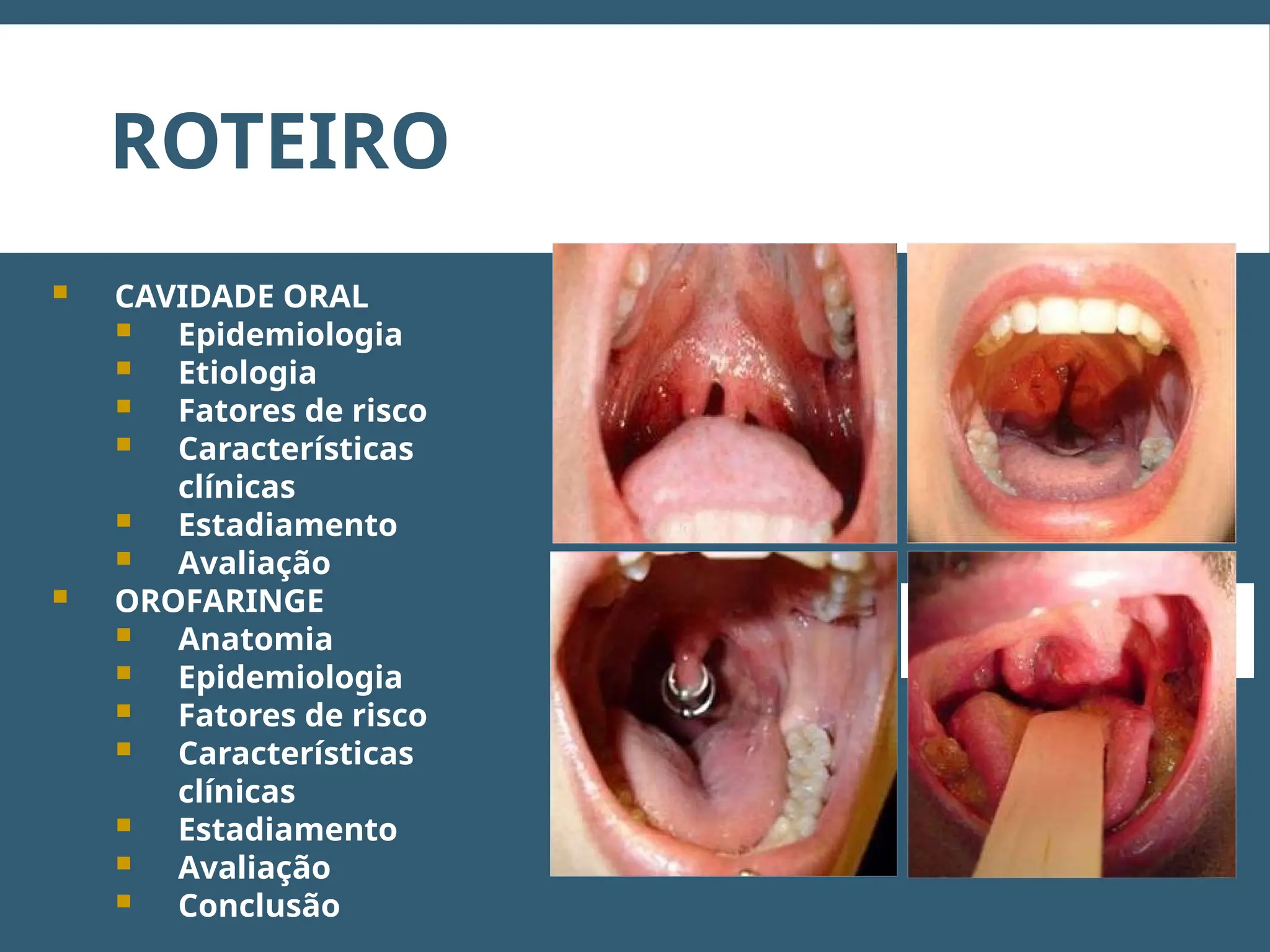 semiologia e fisiologia da cavidade oral e orofaringe.pptx