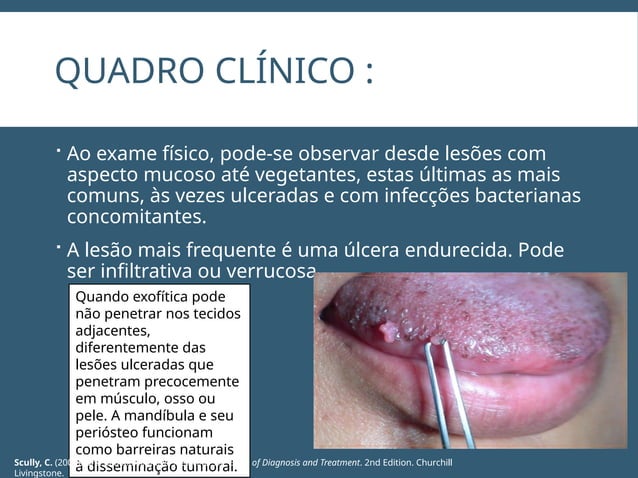 semiologia e fisiologia da cavidade oral e orofaringe.pptx