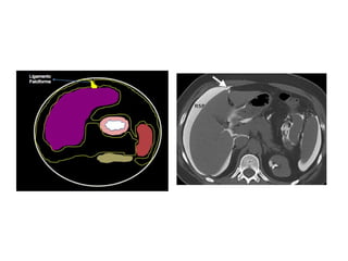 Parede Abdominal e Cavidade Peritoneal | PPT
