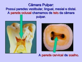 cavidade_pulpar_cavidade_pulpar.pptpulpa | PPT