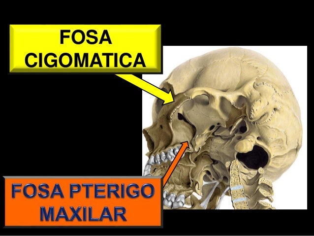 CAVIDADES CRANEOFACIALES