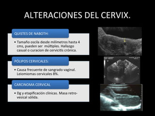 Ultrasonido De Pólipos Cervicales