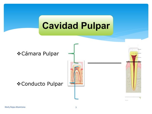 Cavidad pulpar | PPT