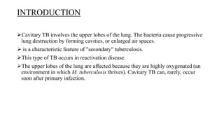 Cavitary tuberculosis | PPT