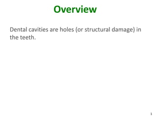 Cavities | PPTX