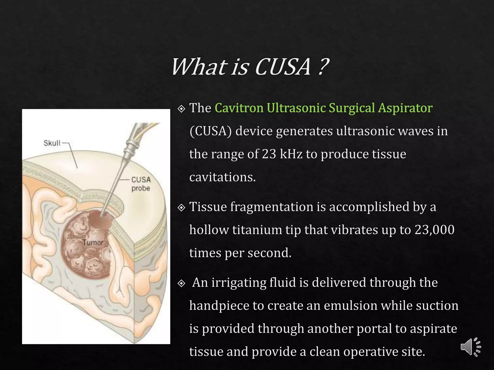 Cavitron ultrasonic surgical aspirator (cusa) | PPTX