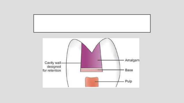 Cavity Bases 1.pptx | Dental Health | Diseases and Conditions