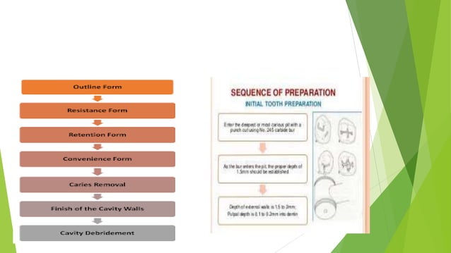 CAVITY DESIGN | PPT