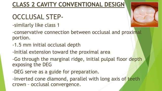CAVITY DESIGN | PPT