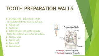 CAVITY DESIGN | PPTX
