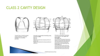 CAVITY DESIGN | PPTX