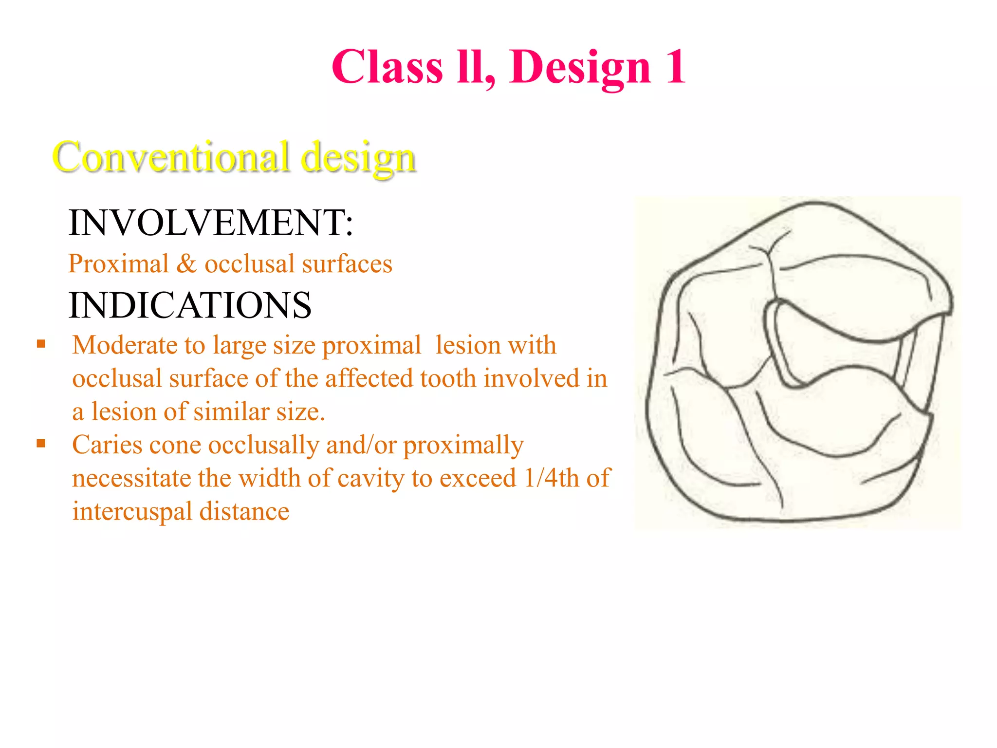 Cavity design for amalgam restoration.pptx
