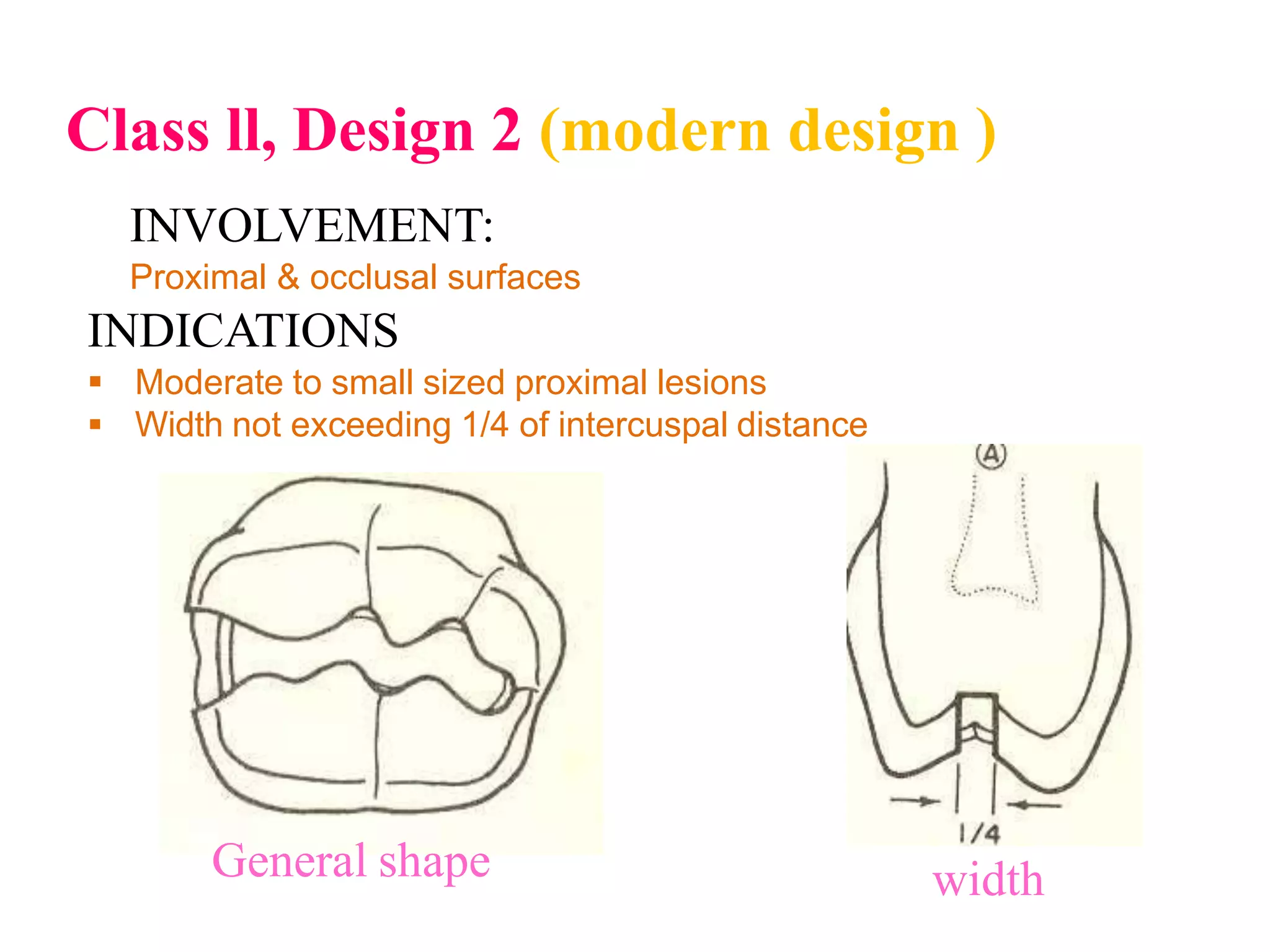 Cavity design for amalgam restoration.pptx