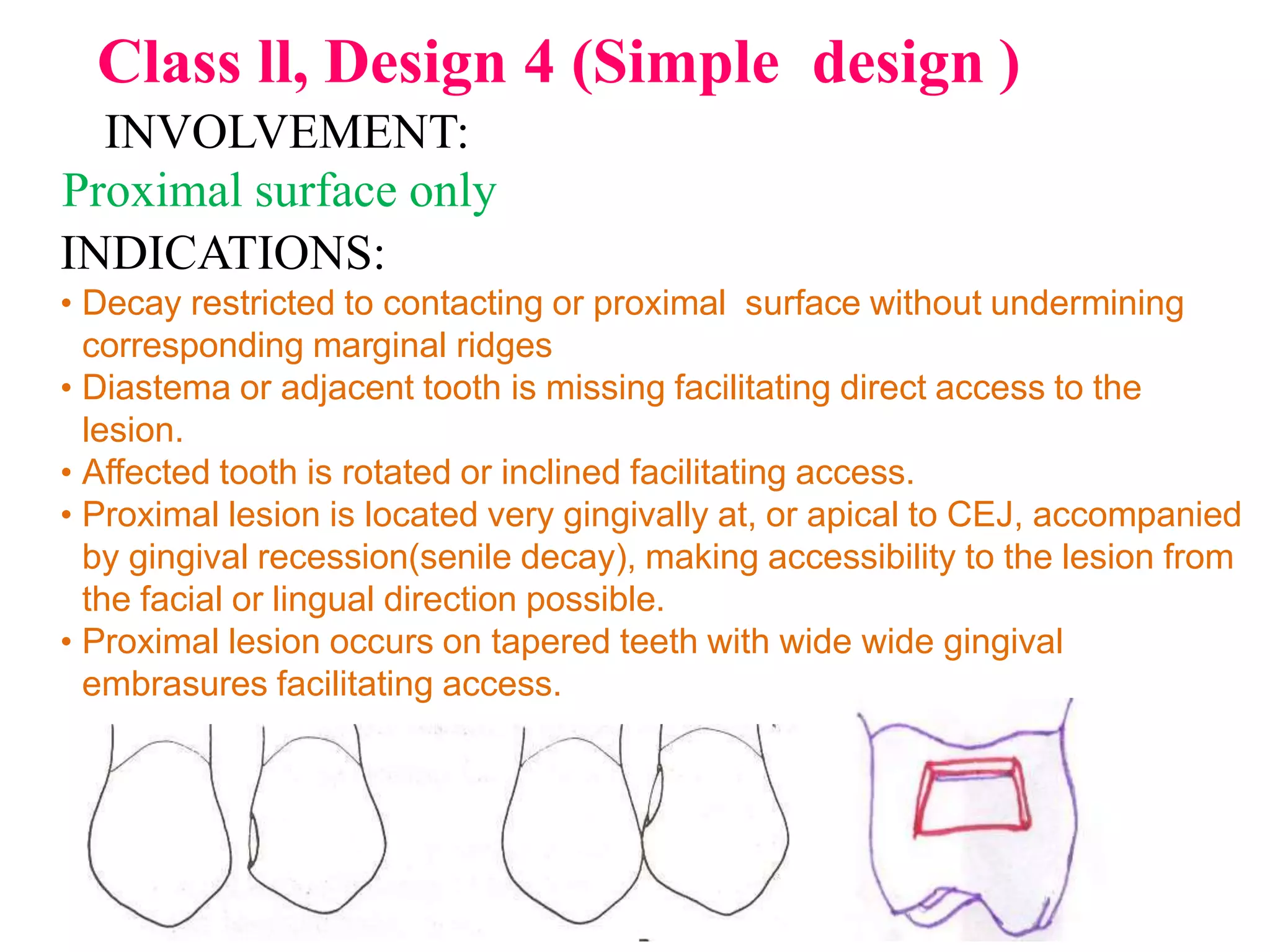 Cavity design for amalgam restoration.pptx