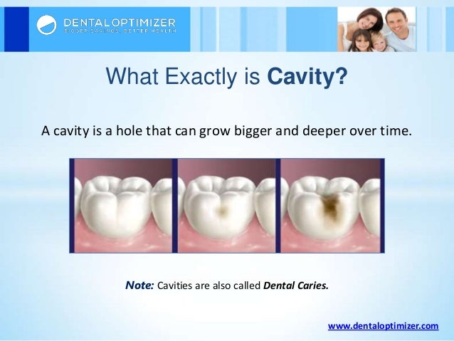 How to detect, prevent and treat cavities