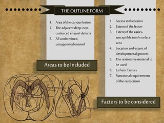 Principles of Cavity preparation | PPTX
