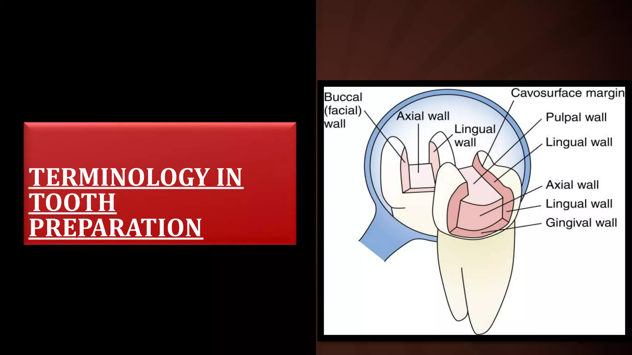 Cavity preparation | PPTX
