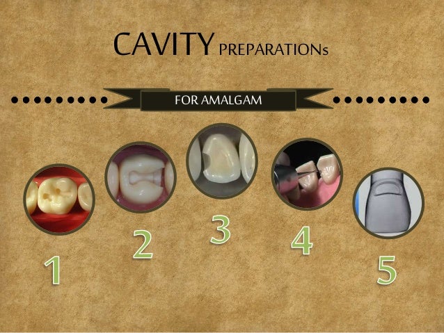 Cavity preparation class 1
