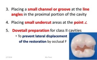 General rules for Cavity Preparations | PPTX